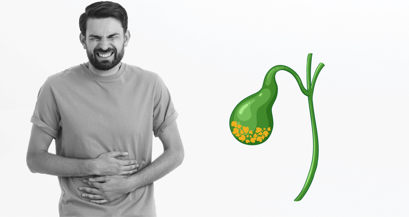 Gallstones Explained: 7 Key Things You Should Know – Ashwini Hospitals